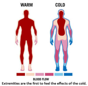 How to recognize hypothermia and frostbite (and other job site cold ...